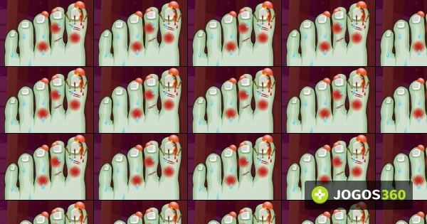 Jogo Monster Foot Doctor no Jogos 360